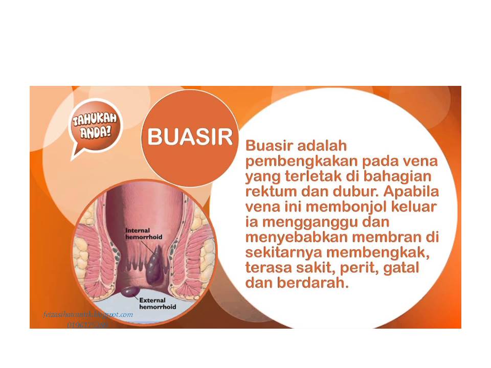 Sihat Dan Cantik Dengan Shaklee: 2017