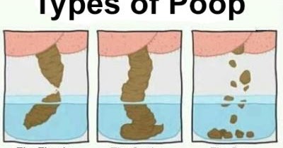 Know The Types Of Poop And What They Reveal About Your Health ...