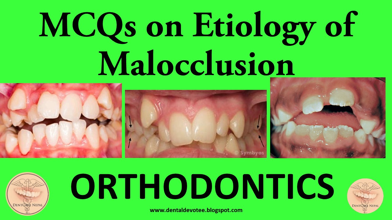 Dentosphere : World of Dentistry: MCQs on Etiology of Malocclusion ...