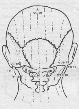 Síndrome de Angelman: Características