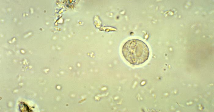 Blognya Arvin: AMUBIASIS, PENYAKIT YANG DISEBABKAN OLEH AMOEBA