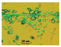 The Role of Gluten Elasticity in the Baking Quality of Wheat