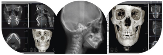 BK Plastic Surgery: Protruding chin correction