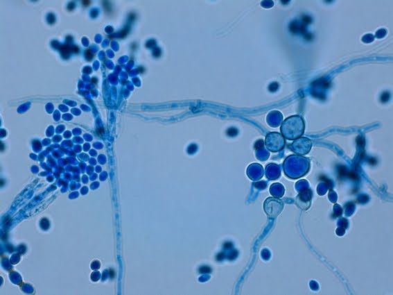 Fun With Microbiology (What's Buggin' You?): Paecilomyces variotii
