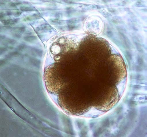 Plant Life: Oomycetes