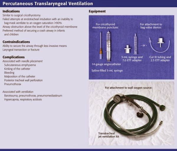 Procedures Club: Surgical Airway, Part Two: Pediatric Translaryngeal ...
