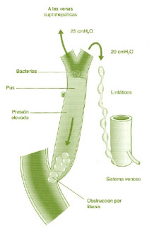 DR. JUAN HERNÁNDEZ ORDUÑA. : Coledocolitiasis y colangitis