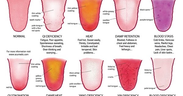 Tongue Diagnoses