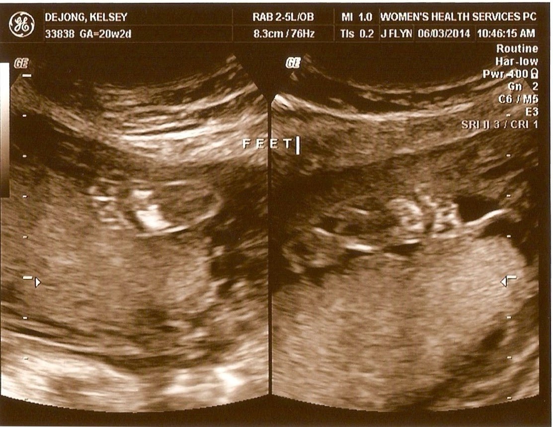 20 week ultrasound. ~ A Day with the De Jongs