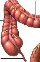 Tanda dan Gejala Anda terkena Usus Buntu (Appendicitis) - sehatsangat