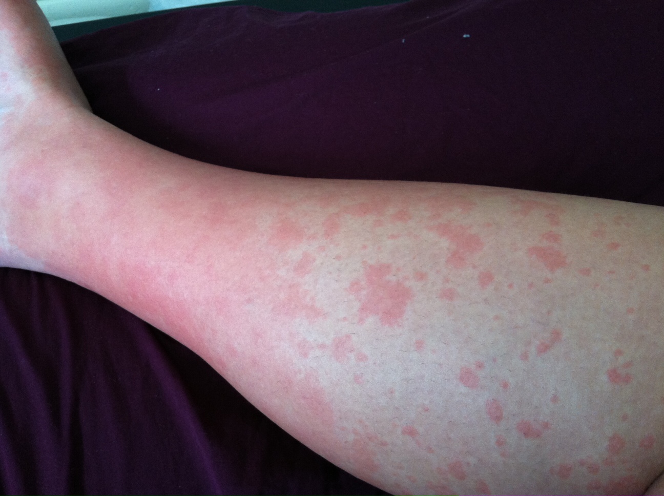 AGAPE Love: A thing called PUPPPS...