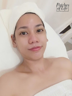 Miss Esthe: Instant Lifting with Meso and Sonic - Patches of Life