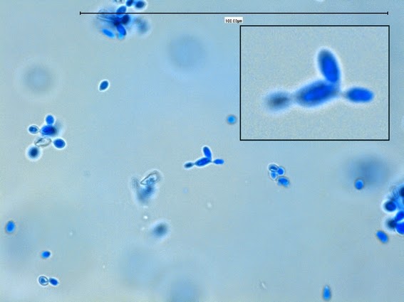 Fun With Microbiology (What's Buggin' You?): Sporothrix schenckii ...