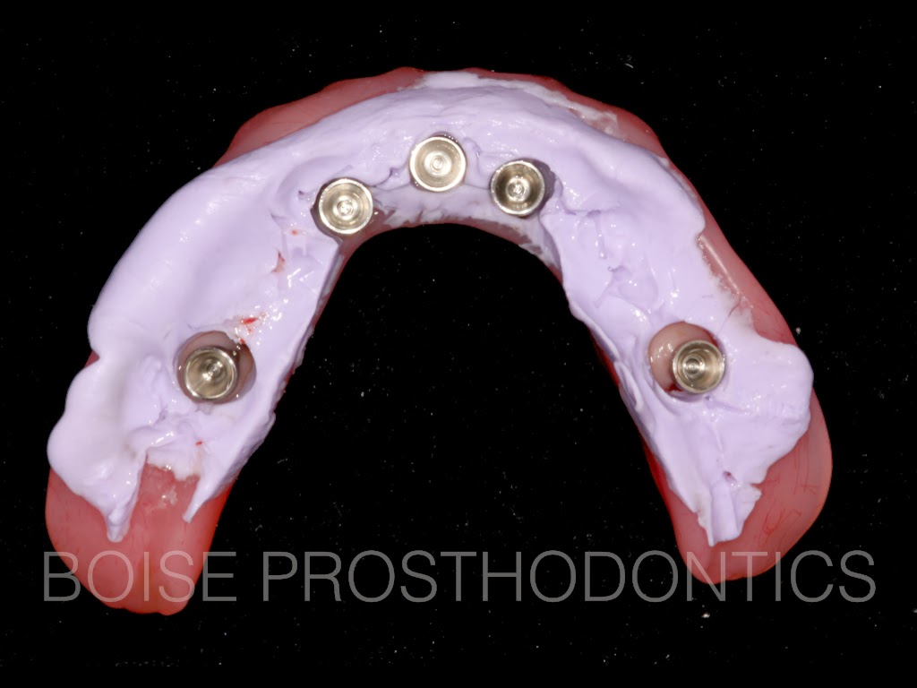 Boise Idaho Prosthodontics