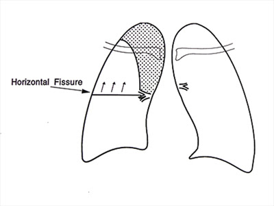 Nos.: Golden S sign.