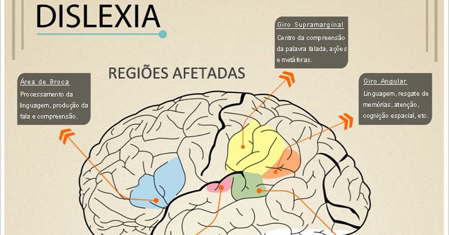 educaçãoespecialeli: Como o disléxico lê e escreve???