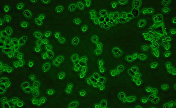 Levaduras y hongos - Naturaleza, Plantas