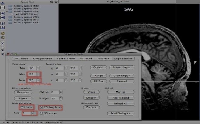 Neuroimaging Made Easy : Brainvoyager QX tips and tricks 2; Create a 3d ...