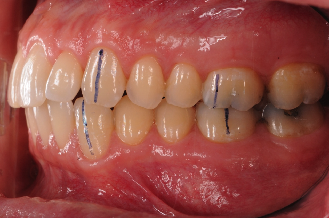 Dental Photography Pearls For Better Images Instantly