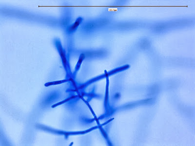 Fun With Microbiology (What's Buggin' You?): Trichophyton terrestre