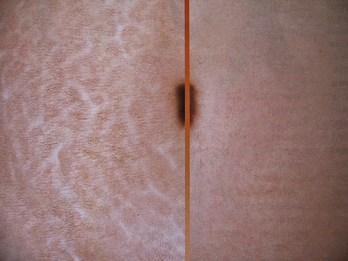 Sweet Gorgeous Centre: SELULIT