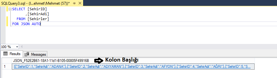JSON Kullanımı (MS SQL)