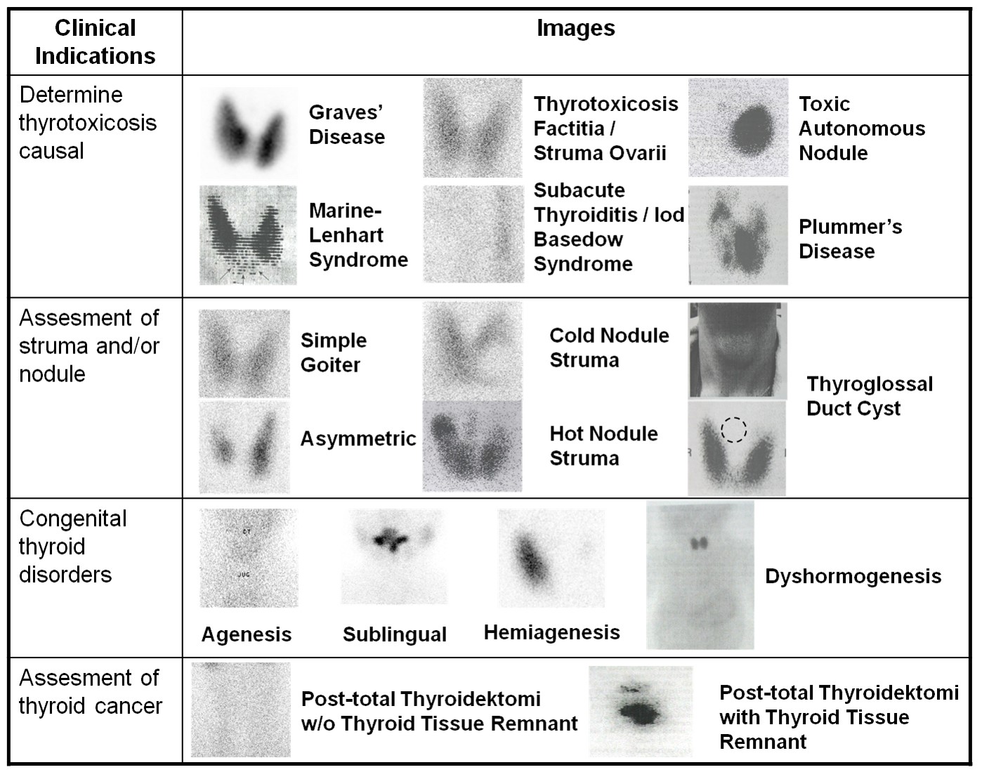 Dokter Nuklir: Saya kan sakit tiroid, kenapa disuruh foto???