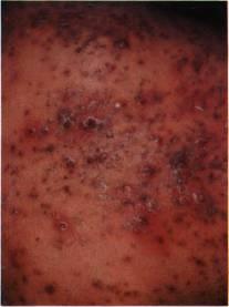 Way I understand the world: PCB (Poly Chlorinated Biphenyl) Pollution