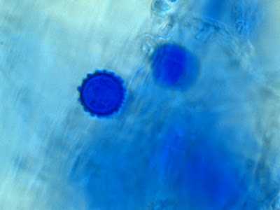 Fun With Microbiology (What's Buggin' You?): Sepedonium species