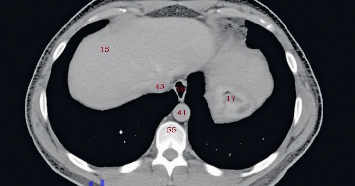 Anatomy CT Axial Abdomen and Pelvis Male