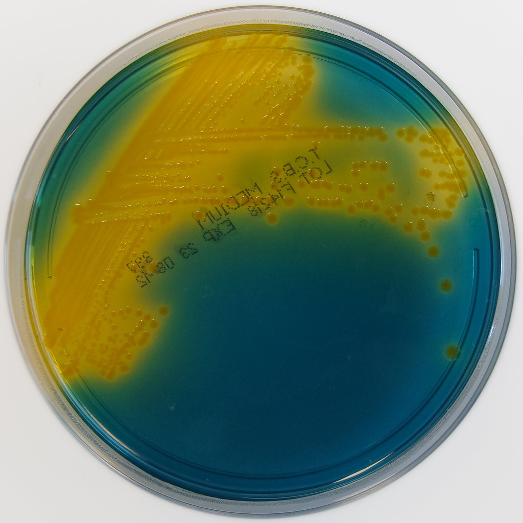 Universo Microbiológico: Vibrio cholerae