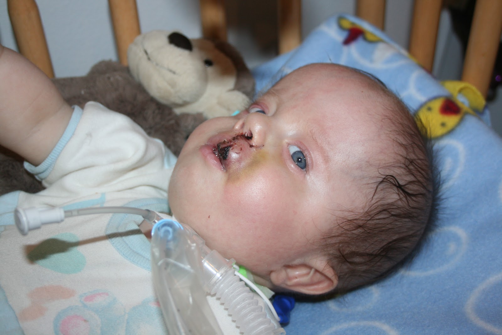 Compatible With Joy-Trisomy18: 07/01/2011 - 08/01/2011