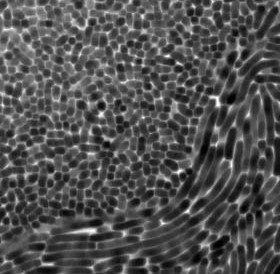 Of Bacteria and Men: Fluorescent bacteria under the microscope