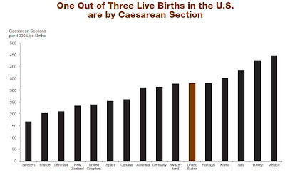 CONVERSABLE ECONOMIST: C-Sections: Trends and Comparisons