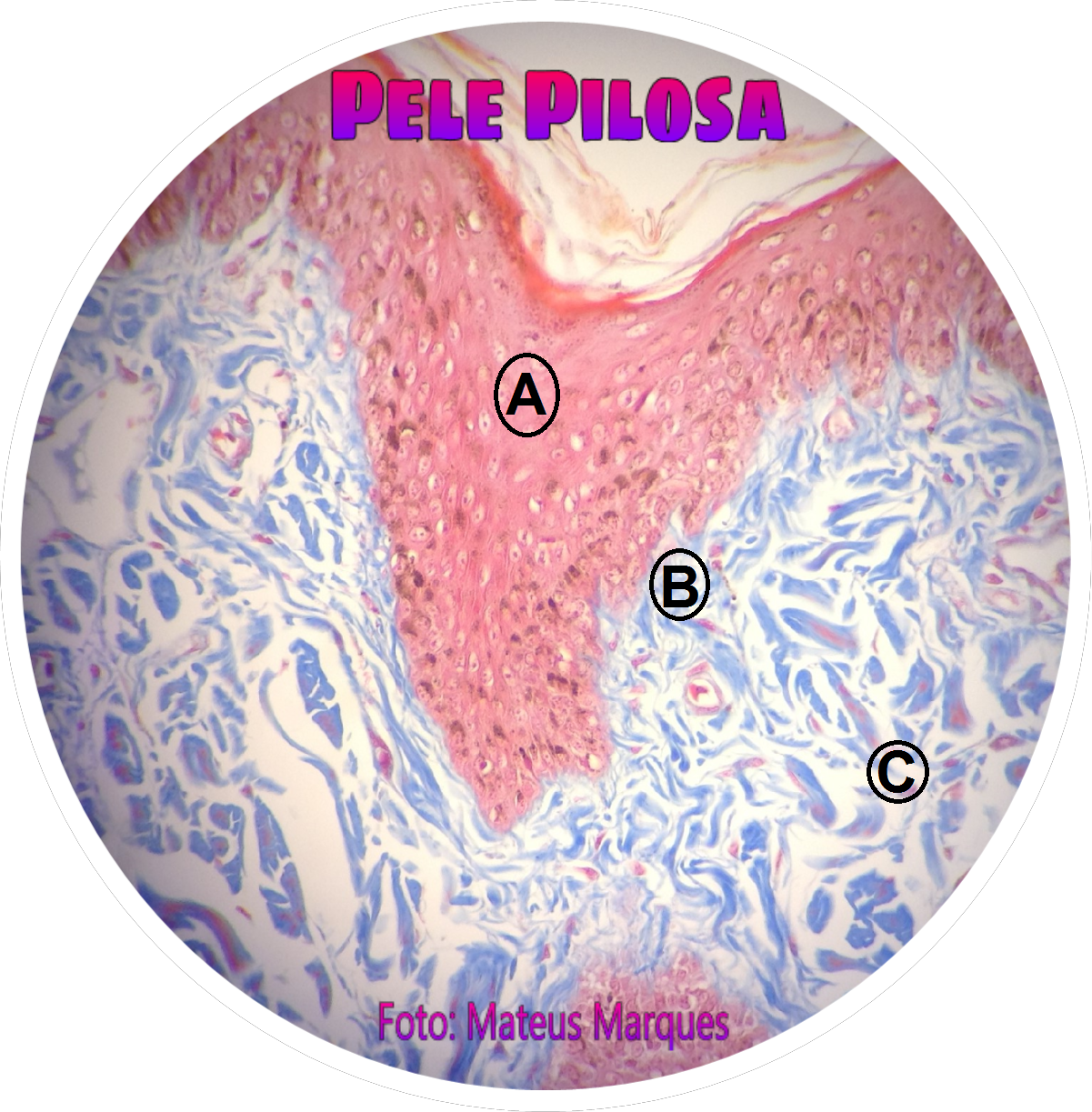 Pele Pilosa (Camadas)