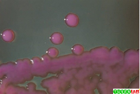 [Microbiology] Atlas of Enterobacteriaceae | Free Medical Atlas