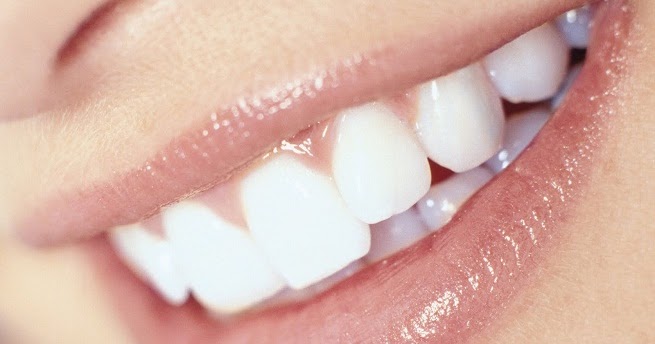 Los Dientes: Los dientes :)