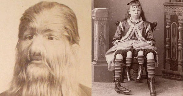 About History: 25 Photos Of “Freak Shows” That Are Thankfully A Thing ...