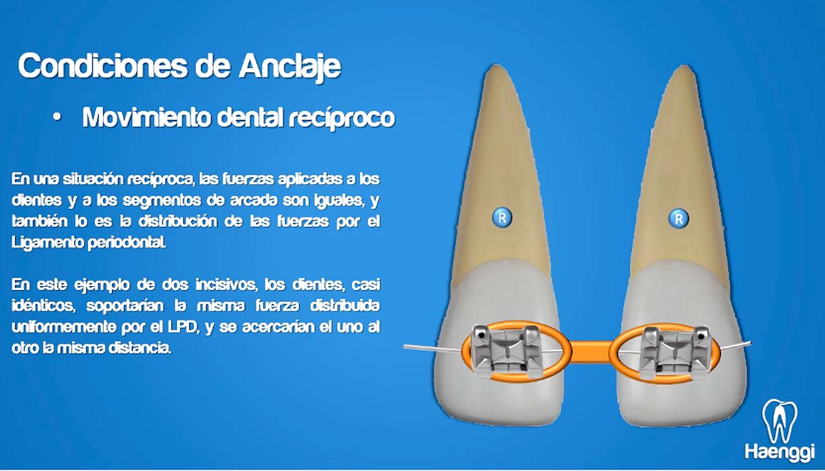 ANCLAJE en ORTODONCIA - Od. Esp. Mauricio Haenggi