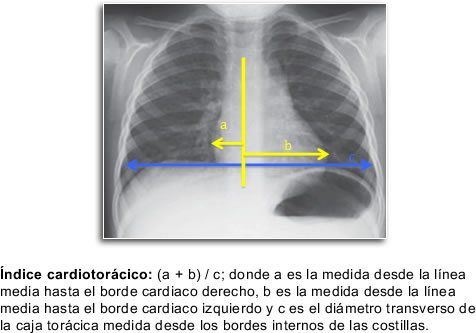 Pruebas de Función Pulmonar y Ayudas Diagnosticas: PLACA DE RX. TORAX