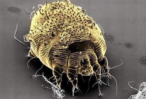 Kenali gejala, penyebab penyakit scabies (kudis, gudik) beserta cara ...