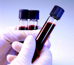 DE BEM COM A VIDA: Tudo sobre o sangue e algumas curiosidades