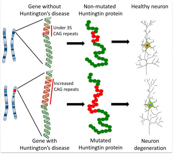 HUNTINGTON'S DISEASE by Esteve Miràngels | MALALTIES GENÈTIQUES
