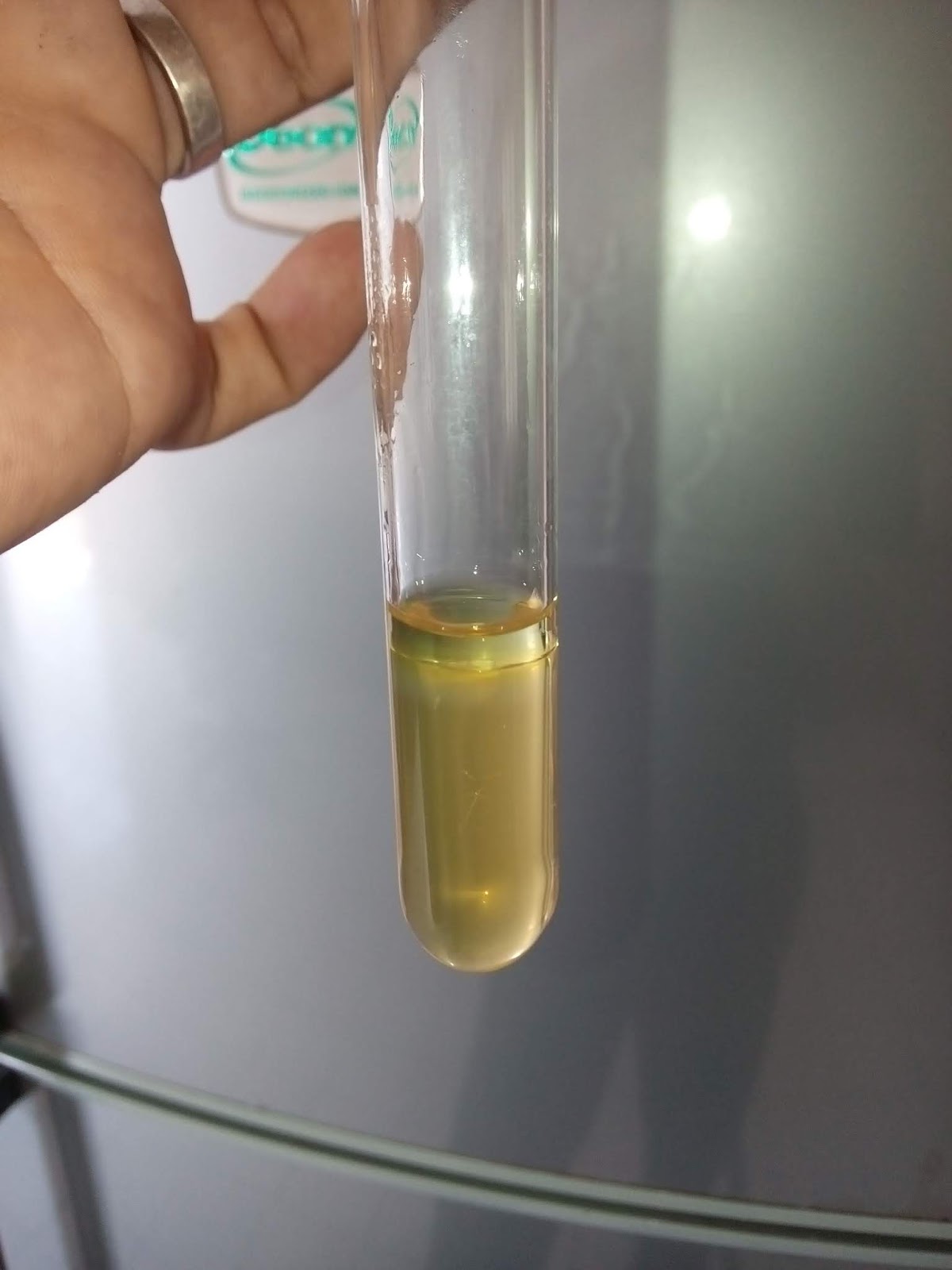 BIOLOGICAL CONTROL: IDENTIFIKASI BAKTERI MELALUI UJI BIOKIMIA