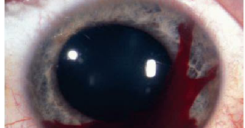 Resumen anatomia humana pdf: HIPEMA Y MICROHIPEMA