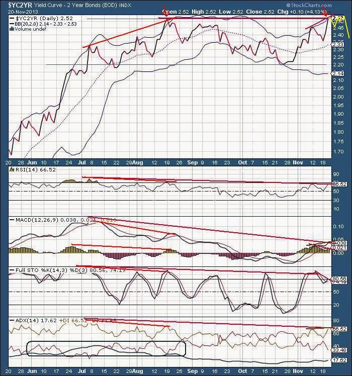 $YC2YR Treasury Notes Yield Curve 2-10 Spread Daily Chart - Bear Bitcoin