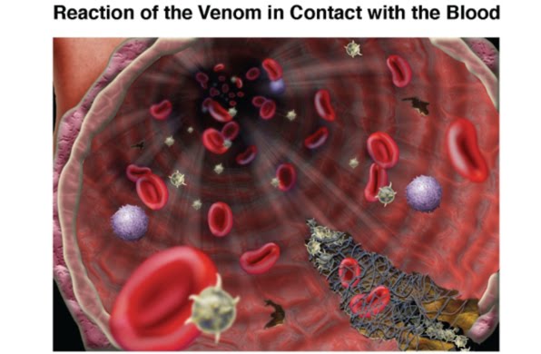 The Silent Killer Hemotoxin vs Blood: November 2012