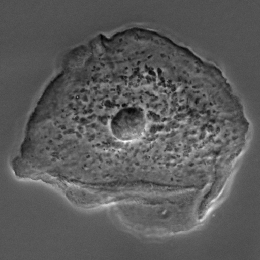 Cheek Cells Under Microscope Black And White