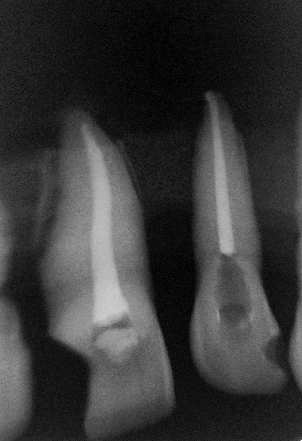 SECCION PARA ALUMNOS ENDODONCIA I: ATENCION ALUMNOS ENDO I