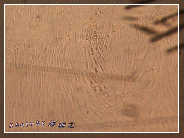 努力不一定會成功, 但成功一定需要努力!: CPE照片分享 - Cytomegalovirus (CMV, 巨細胞病毒)